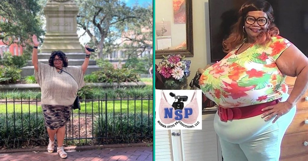 65-jarige vrouw heeft 's werelds grootste natuurlijke 'meloenen' - BRAW.NL